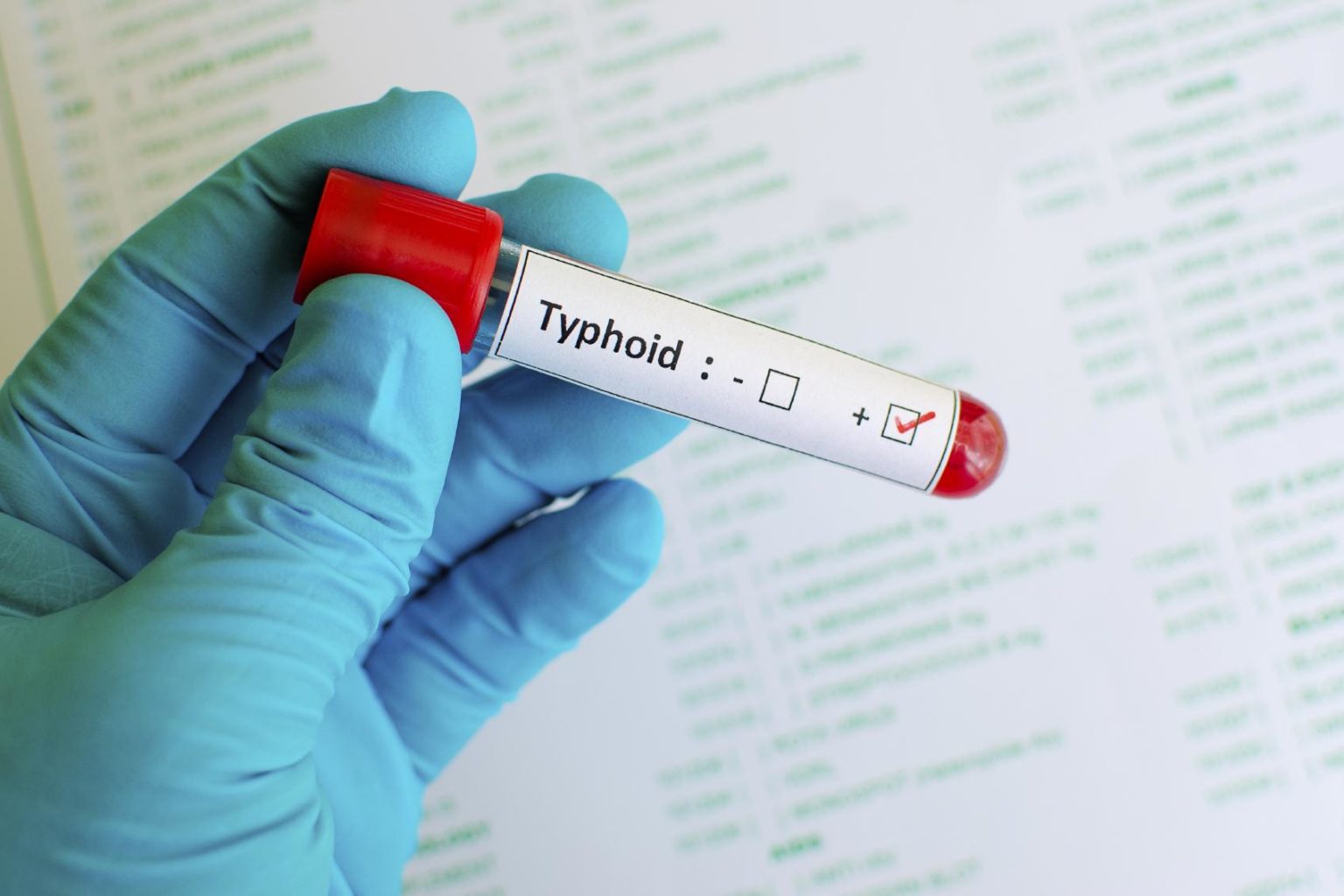Bacteria de tifoidea cada vez resiste más los antibióticos