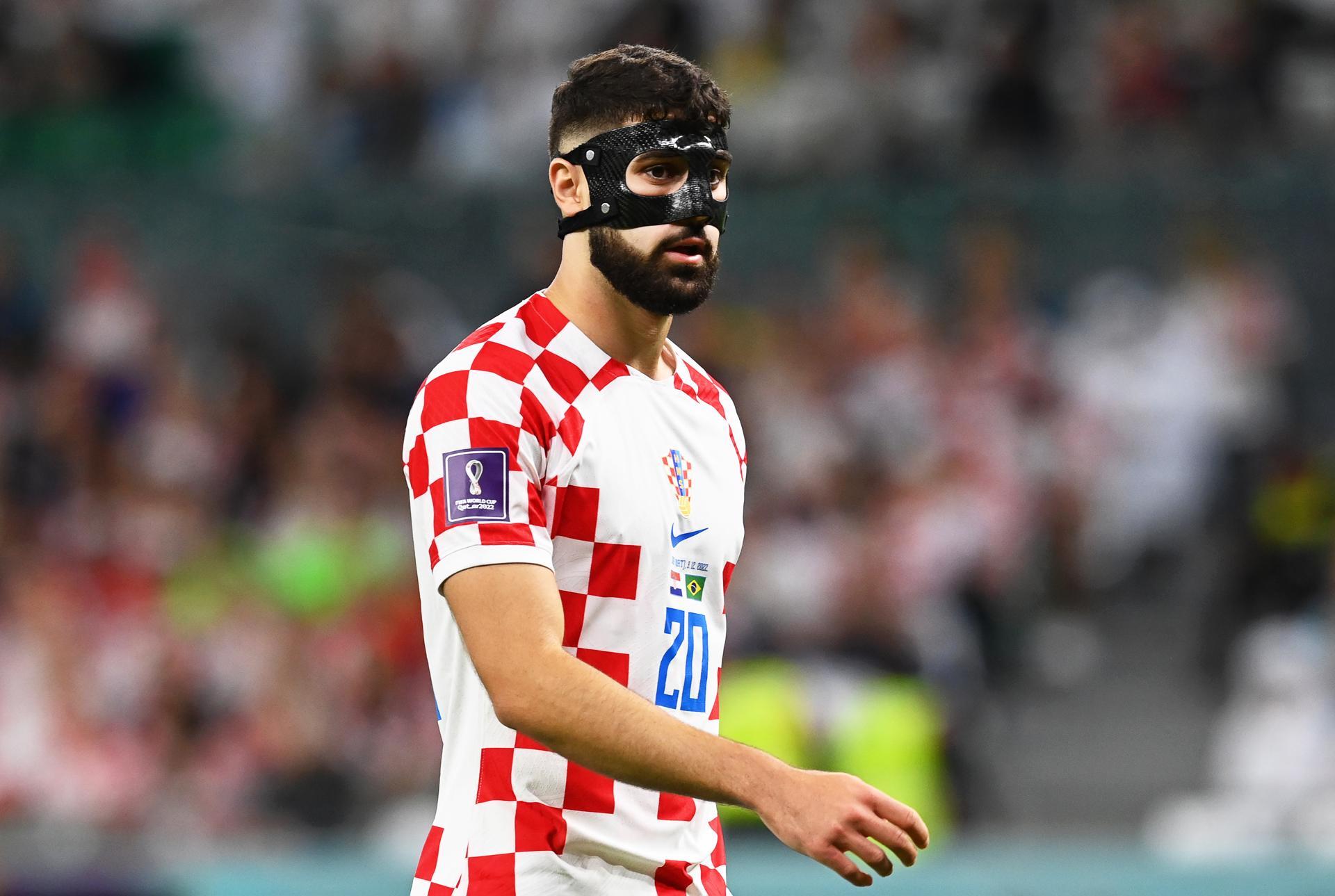 ¿Por qué algunos jugadores usan una máscara de super héroe?